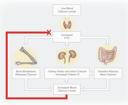 Hyperparathyroidism - SMARTY PANCE