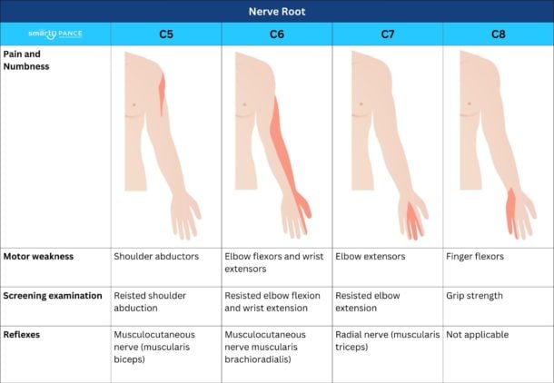 Radiculopathy Rapid Review: Cervical and Lumbar Patterns - Smarty PANCE