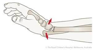 Smith Fracture Garden Spade