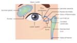 Dacryoadenitis and Dacryocystitis - Smarty PANCE
