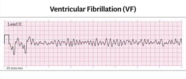 SMARTY PANCE | Cardiology NCCPA Blueprint Review Course