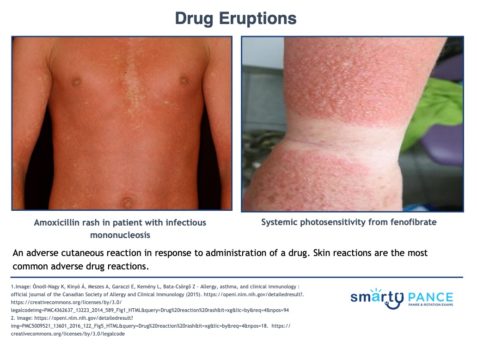 Emergency Medicine Rotation: Dermatology (PEARLS) - Smarty PANCE