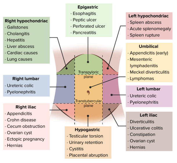 General Surgery: Abdominal pain - Smarty PANCE