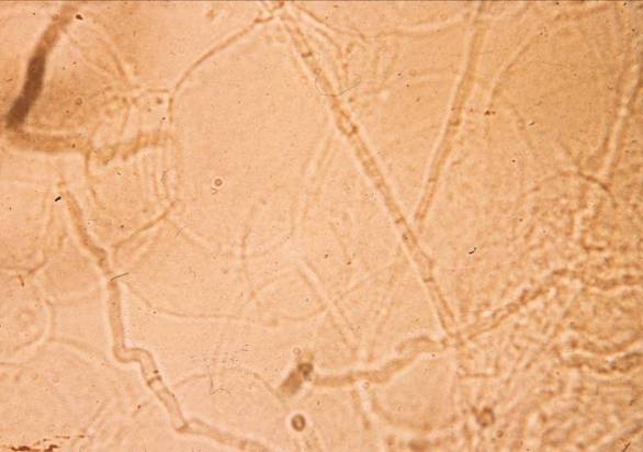 SMARTY PANCE | NCCPA Dermatology Blueprint Review Course