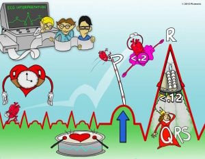 EKG Interpretation (Picmonic) - SMARTY PANCE