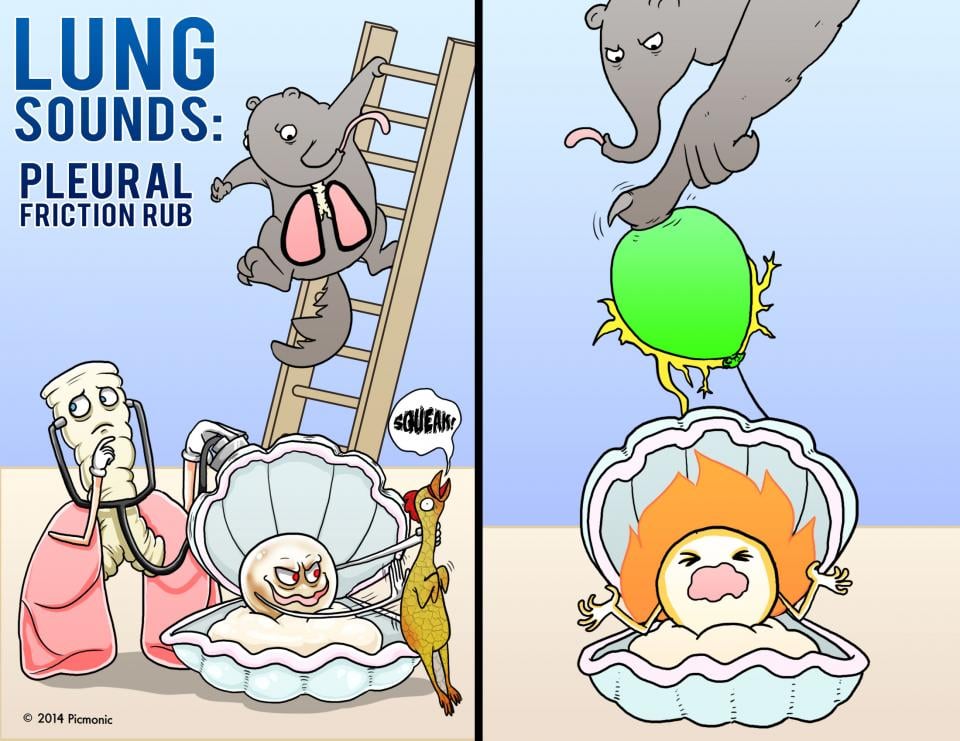 Pleural Diseases (PEARLS) | Pulmonary System Blueprint | SMARTY PANCE