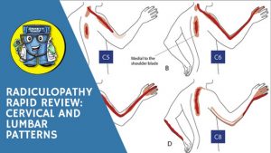 Radiculopathy Rapid Review: Cervical and Lumbar Patterns - Smarty PANCE