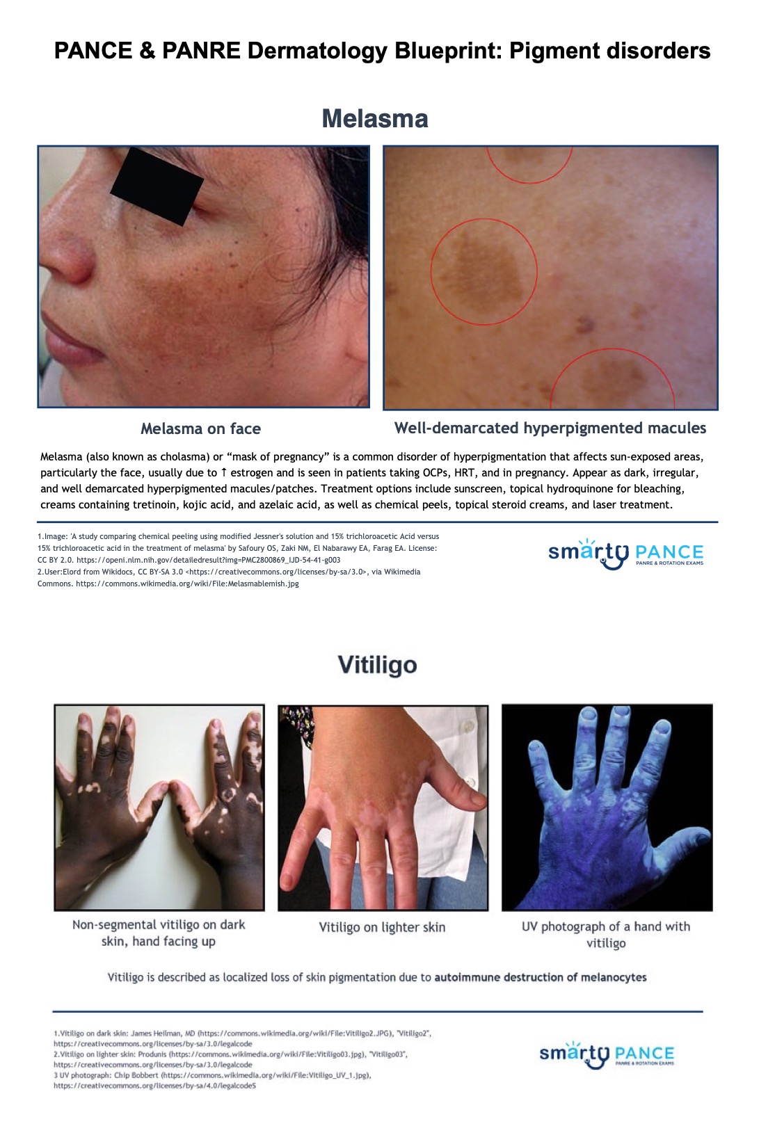Pigment Disorders (PEARLS) | Dermatology System - Smarty PANCE