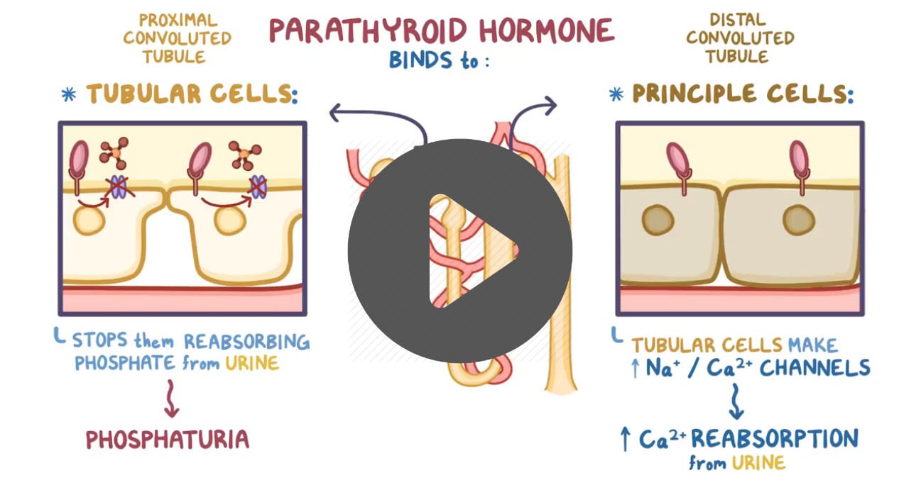 Hyperparathyroidism - SMARTY PANCE