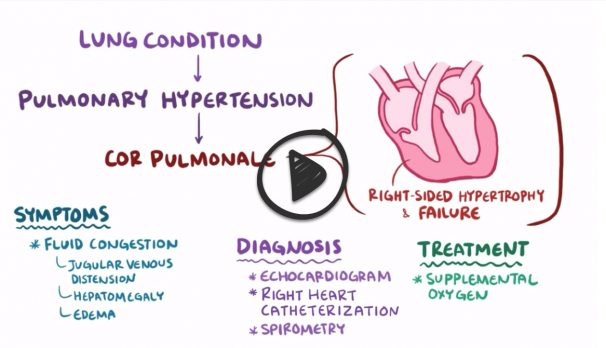 Cor pulmonale - Smarty PANCE