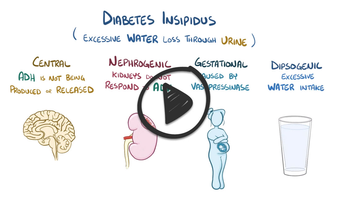 Diabetes insipidus (ReelDx + Lecture) | SMARTY PANCE