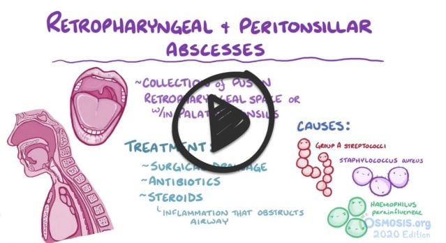 Peritonsillar Abscess | PANCE EENT Content Blueprint - Smarty PANCE