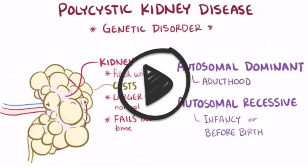 Polycystic Kidney Disease | PANCE Genitourinary Blueprint - Smarty PANCE