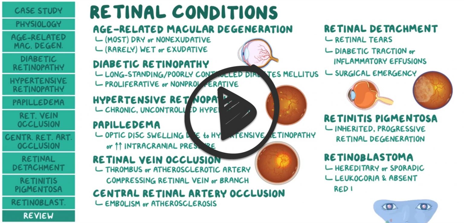 Retinal disorders (PEARLS) - Smarty PANCE