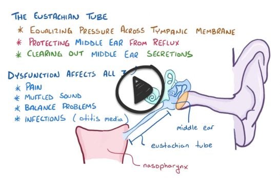 Dysfunction of the eustachian tube - Smarty PANCE