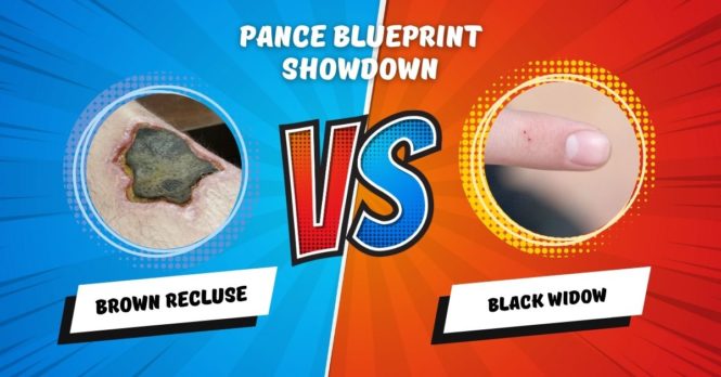 PANCE Blueprint Showdown: Black Widow vs. Brown Recluse Spider Bites ...